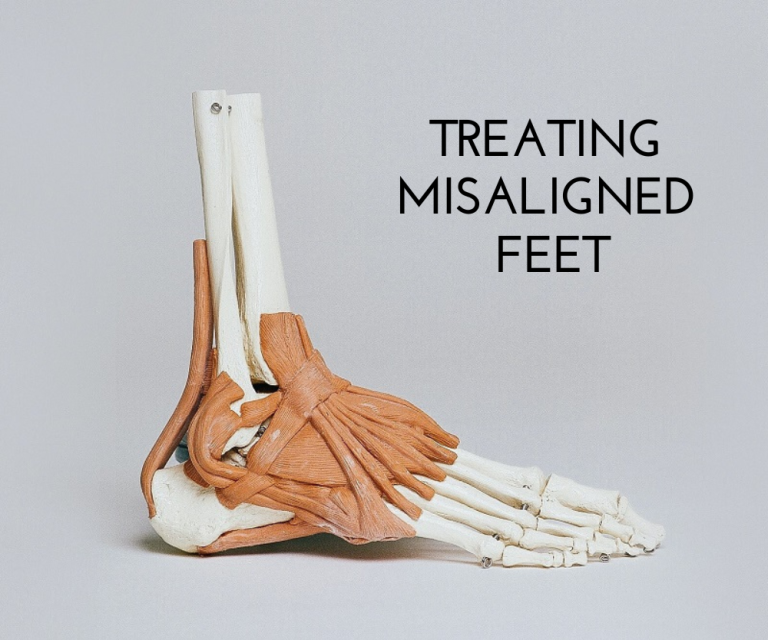 Treating Misaligned Feet | Starrett Podiatry
